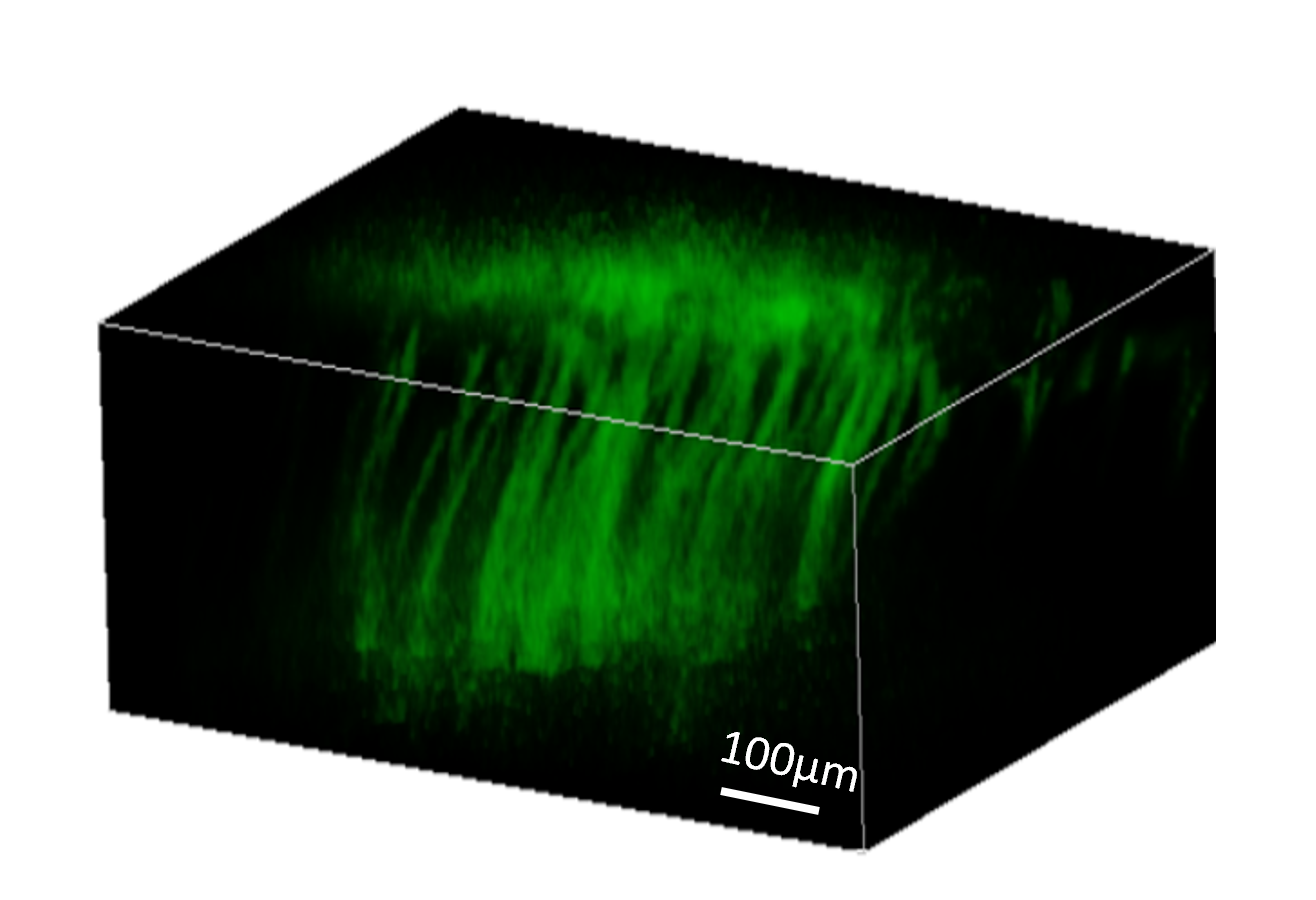 ME researchers receive $1.7M to develop endoscopic microscope that may ...